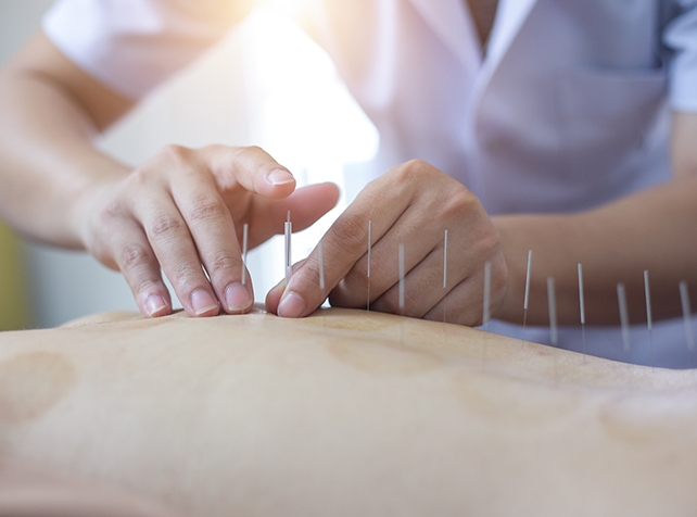 Is dry needling therapy dangerous? - HealthTimes