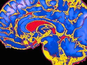 Brain scans show how LSD mimics mind of a baby - HealthTimes