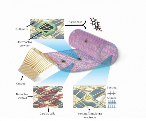 A polymer patch designed to prevent heart attack - HealthTimes
