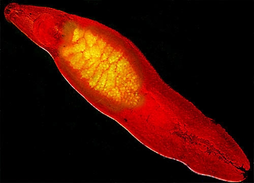 Deadly cancer worm may help heal wounds - HealthTimes